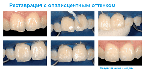 ᐉ IPS Empress Direct наногибридный композит, цена 3 148₴ ᐉ Купить в ...