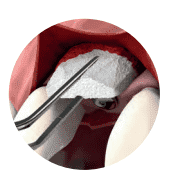 ᐉ Fibro-Gide 20*40 Geistlich, цена 18 781₴ ᐉ Купить в Киеве с доставкой