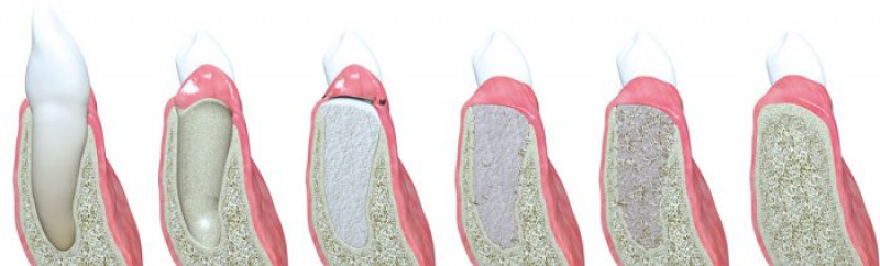 ᐉ Collacone коллагеновый конус, цена 4 769₴ ᐉ Купить в Киеве с доставкой